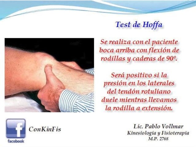 Enfermedad de Hoffa | PPT | Death, Injury, or Military Conflict ...