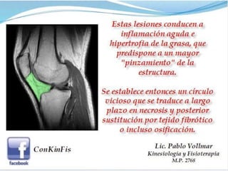 Enfermedad de Hoffa | PPT