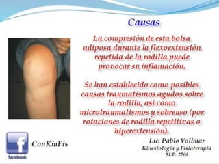 Enfermedad de Hoffa | PPT