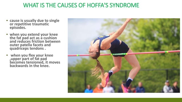 Hoffas Fat Pad Syndromepptx