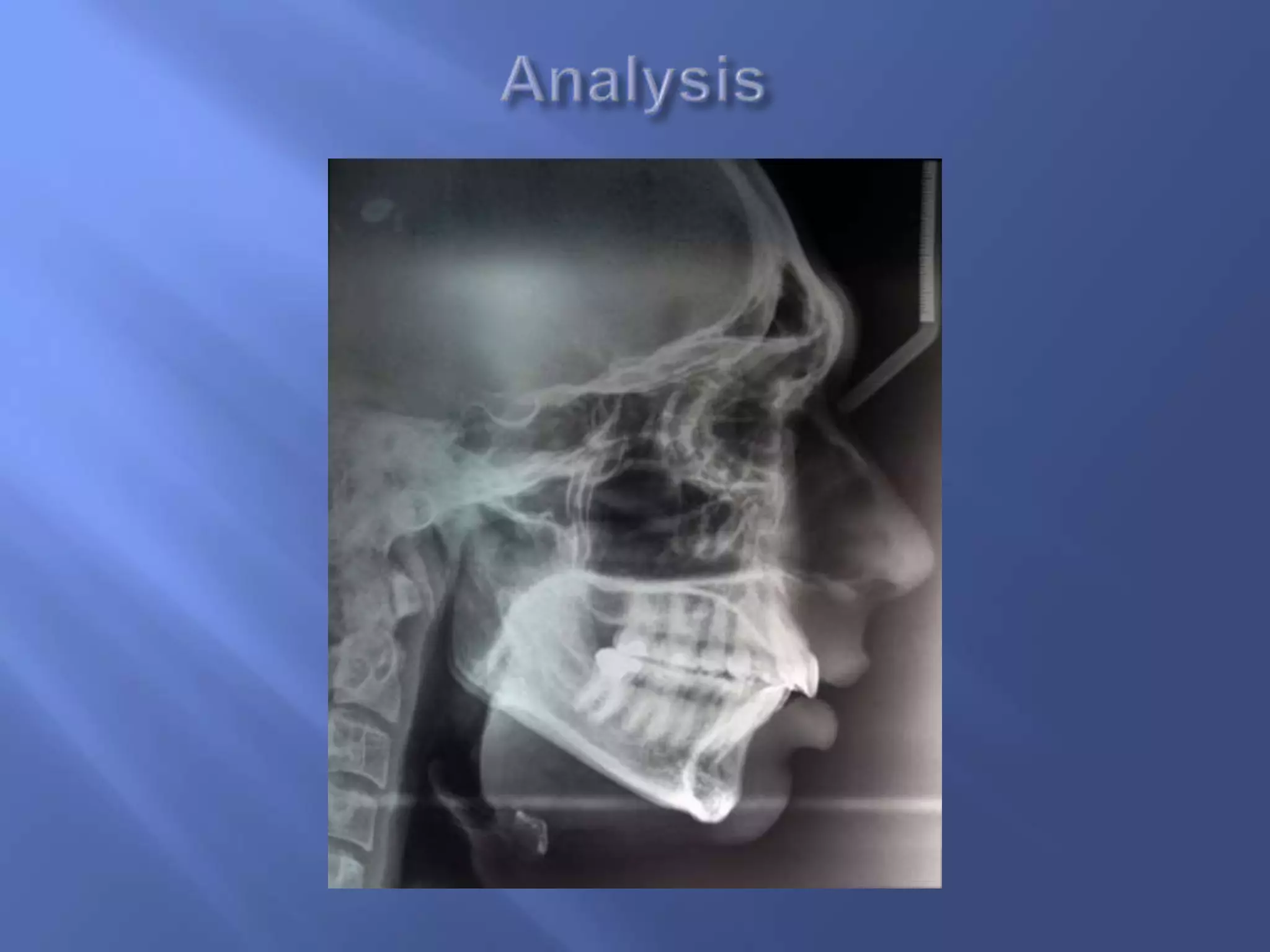 Holdway's analysis | PPTX