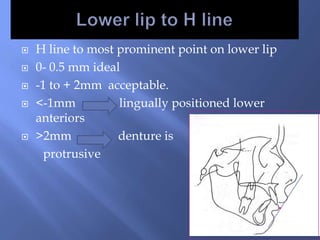 Holdway's analysis | PPTX
