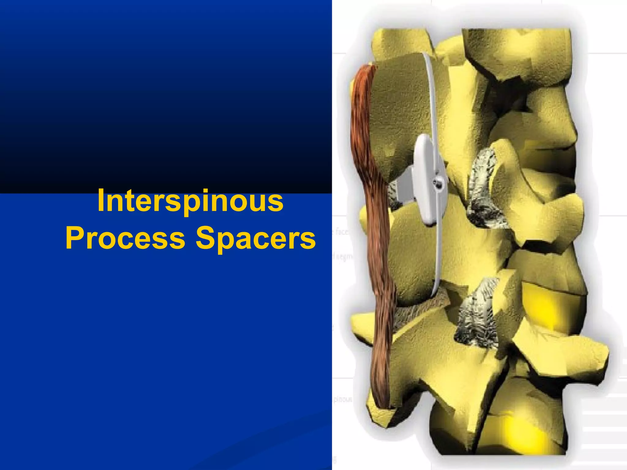 Principles of effective dynamic stabilizations | PPT