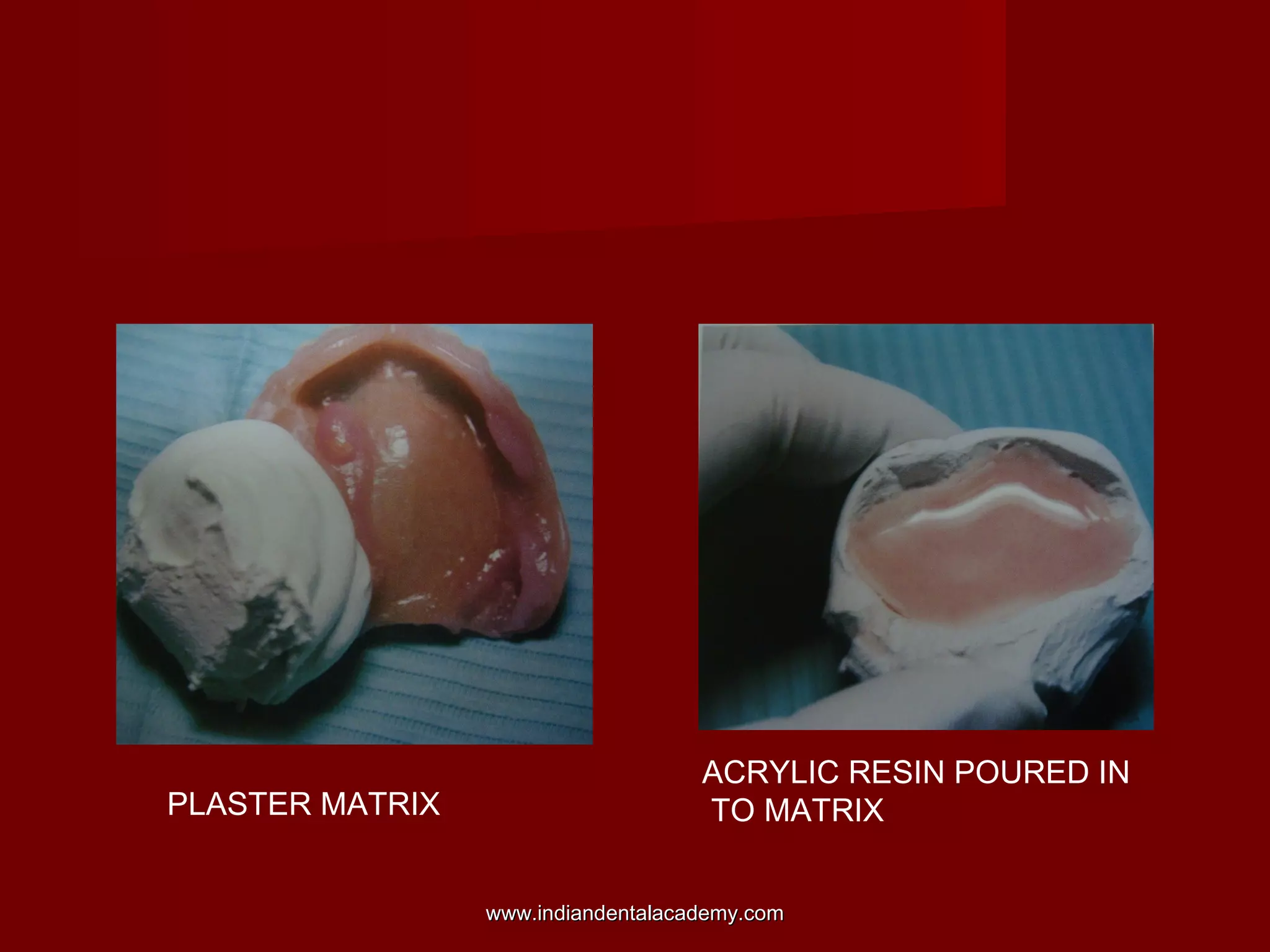 Hollow bulb obturator / cosmetic dentistry courses | PPT