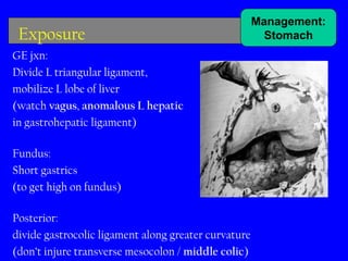 Hollow Viscus Injuries diagnosis & treatment | PPT