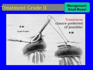 Hollow Viscus Injuries diagnosis & treatment | PPT
