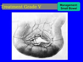 Hollow Viscus Injuries diagnosis & treatment | PPT