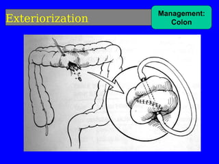 Hollow Viscus Injuries diagnosis & treatment | PPT