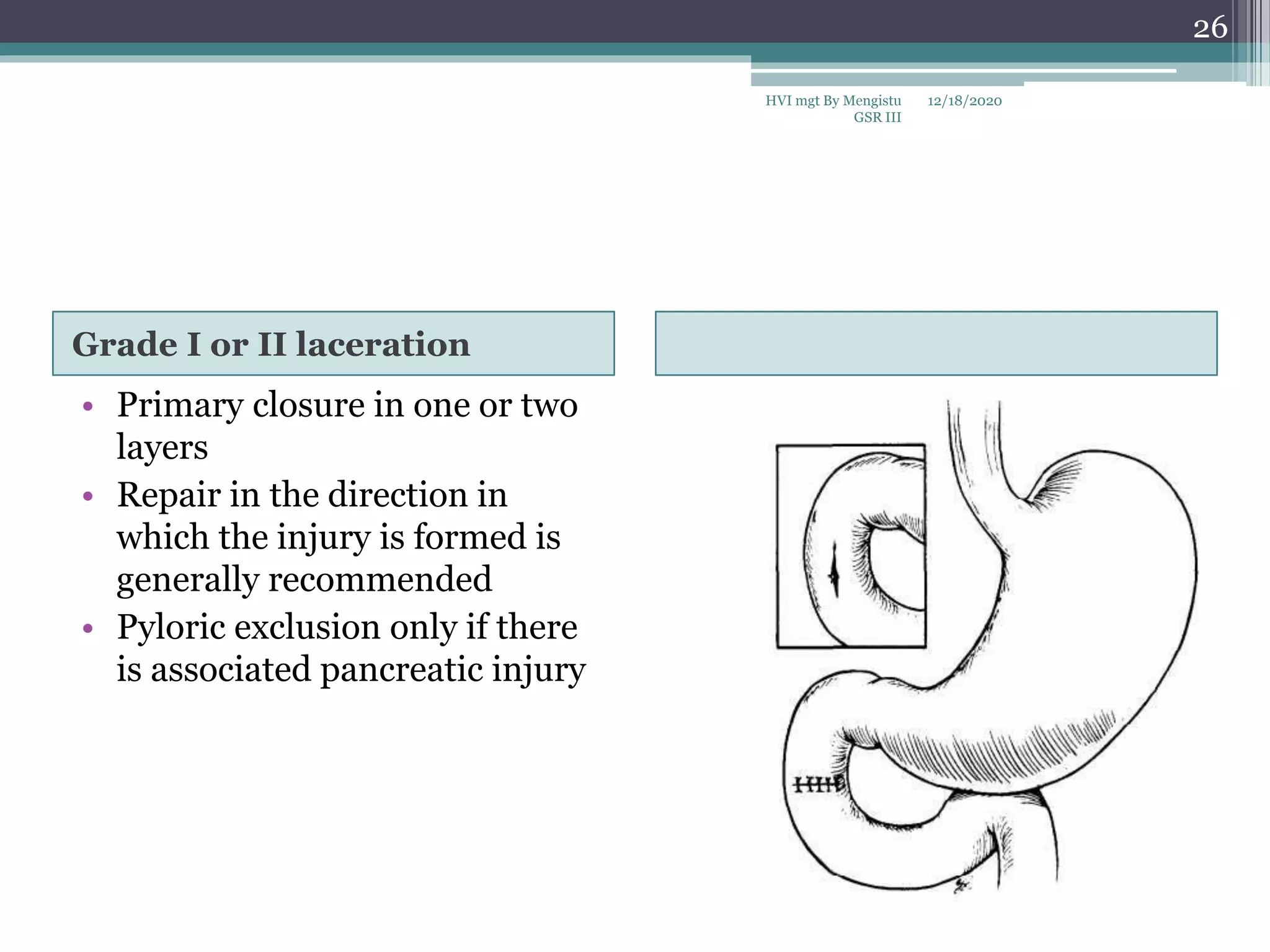 Hollow viscus injury management | PPTX