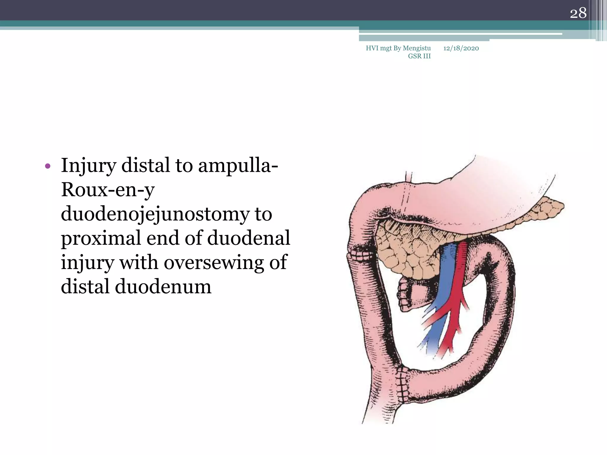 Hollow viscus injury management | PPTX