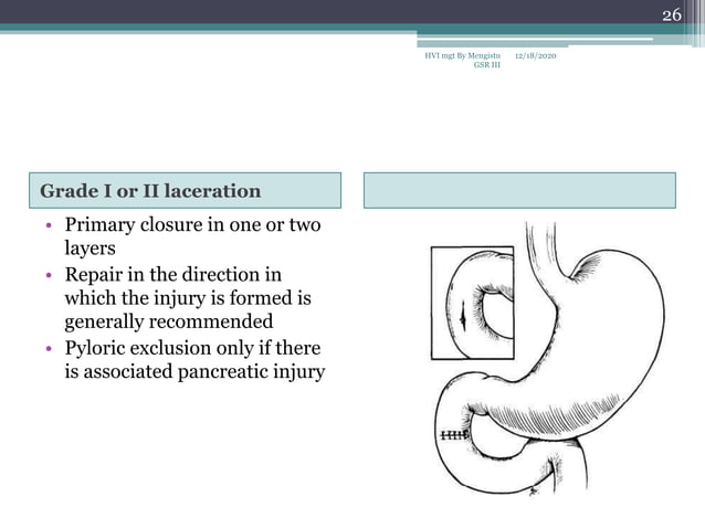 Hollow viscus injury management | PPTX | Death, Injury, or Military ...