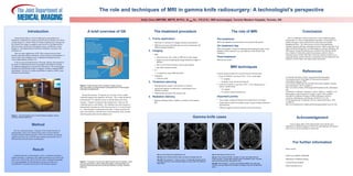 The role and techniques of MRI in gamma knife radiosurgery: a ...