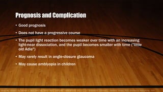 Holmes Adie Syndrome | PPTX