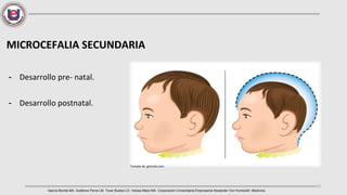 Holoprosencefalia y microcefalia | PPTX