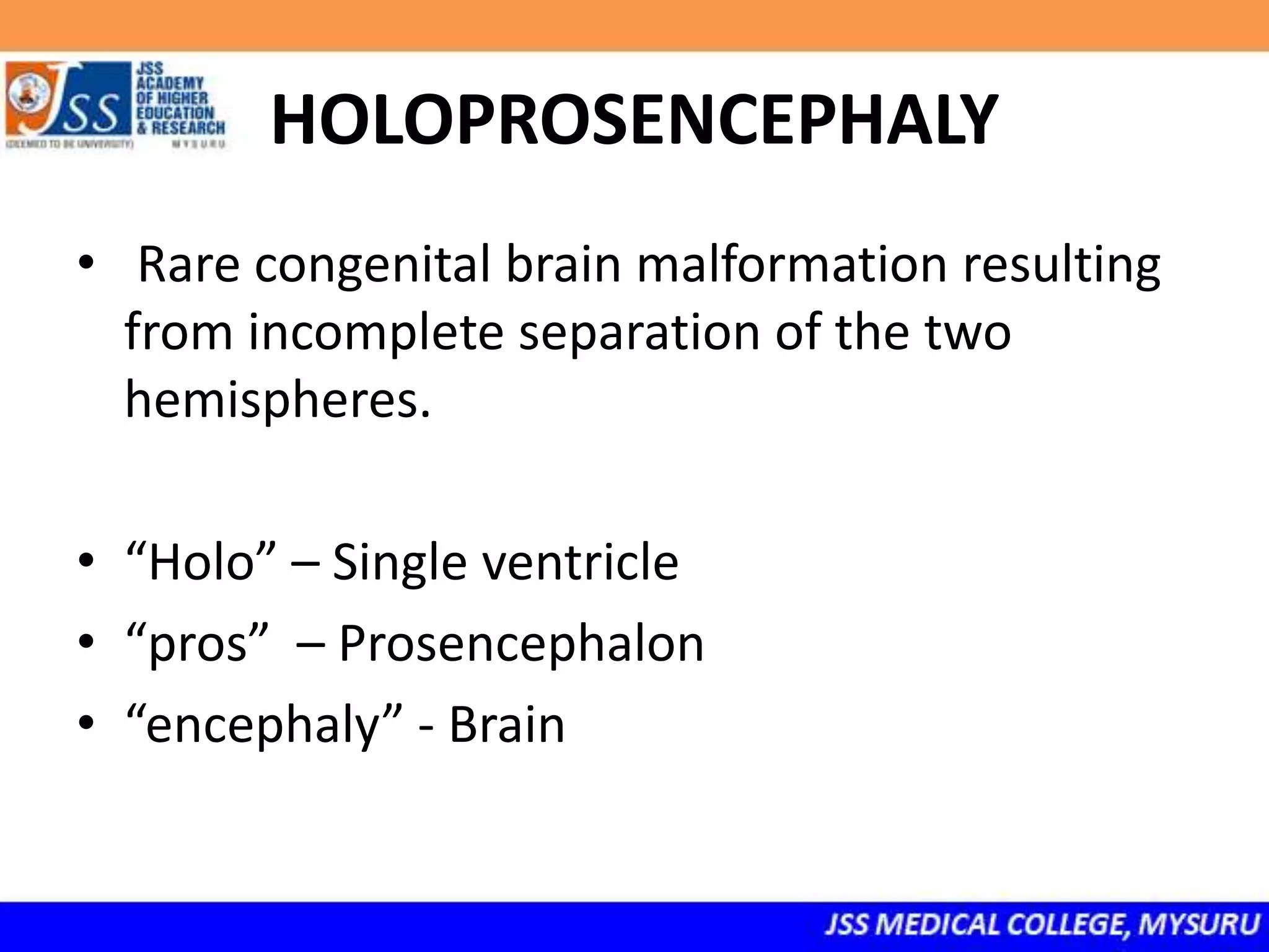 Holoprosencephaly | PPT