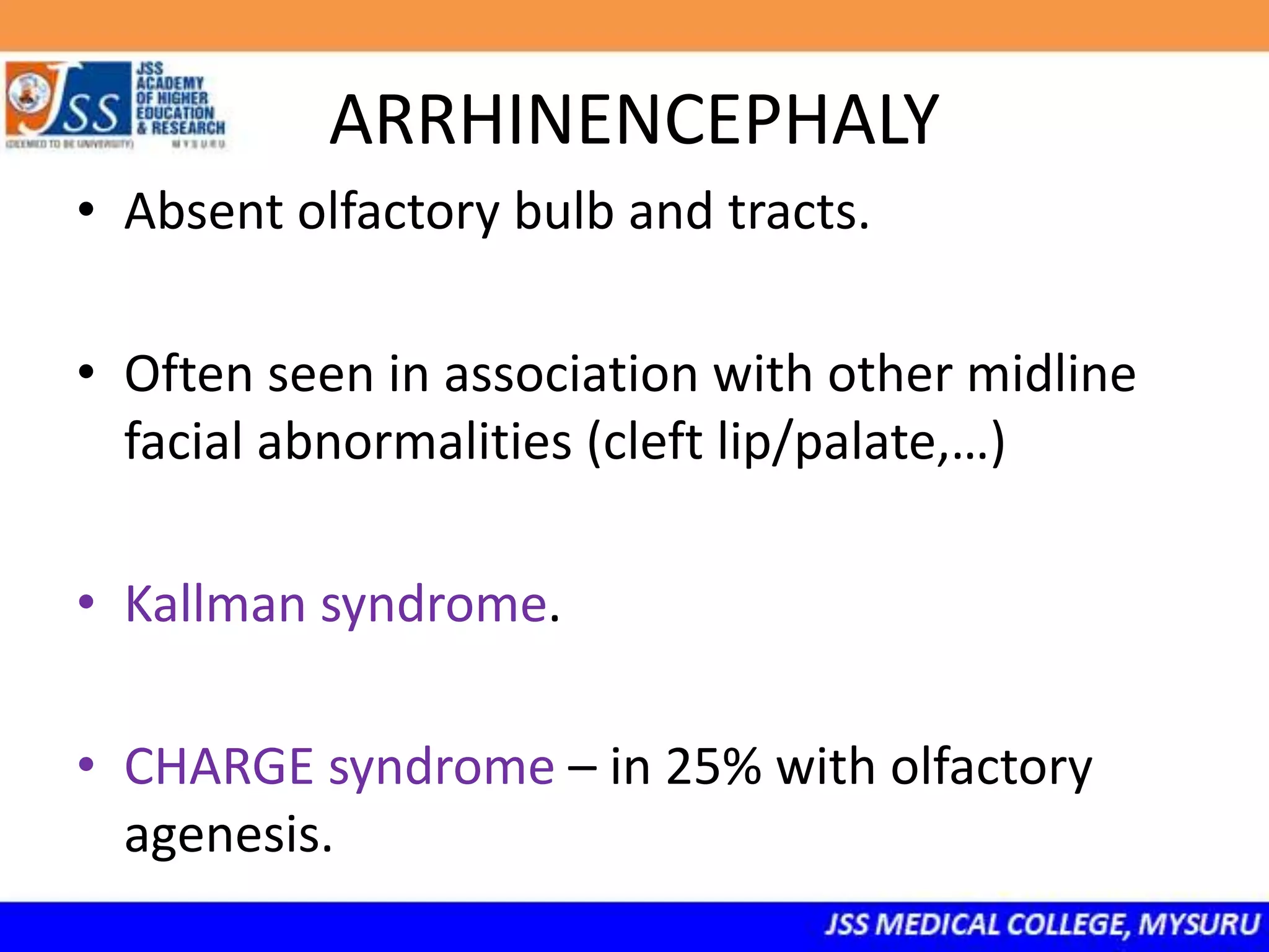 Holoprosencephaly | PPT