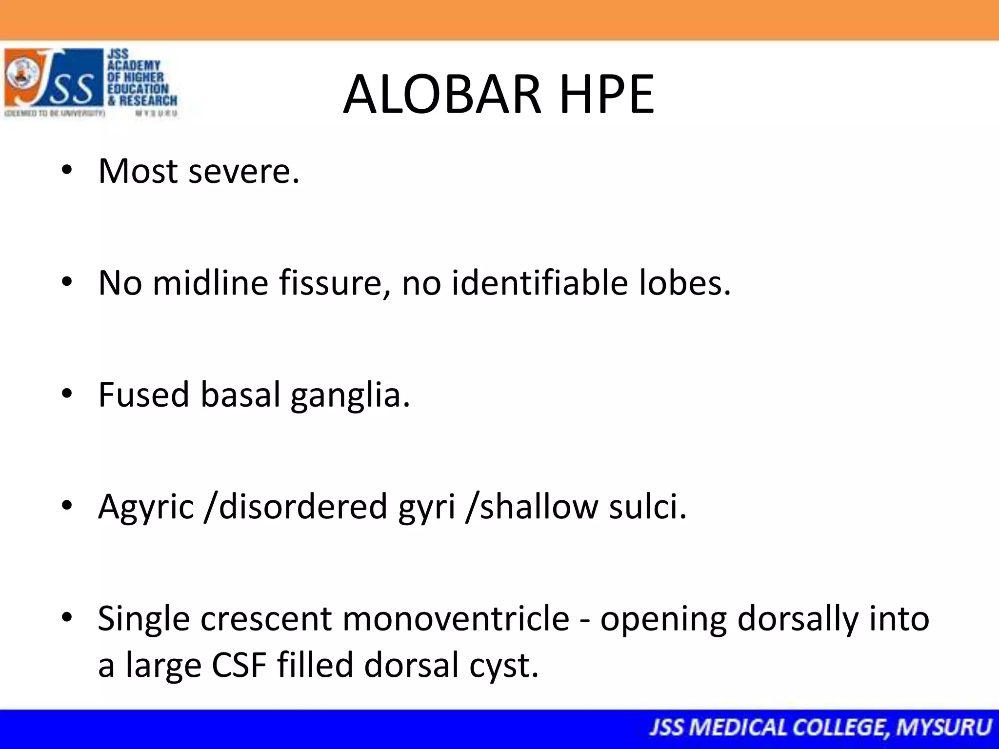 Holoprosencephaly | PPT