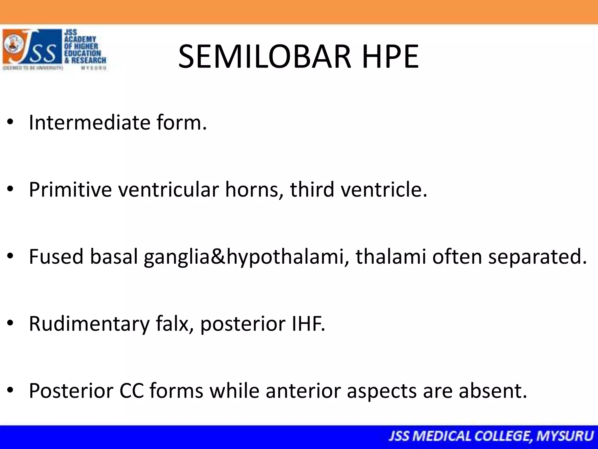 Holoprosencephaly | PPT