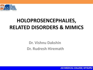 Holoprosencephaly | PPT