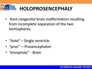 Holoprosencephaly | PPT