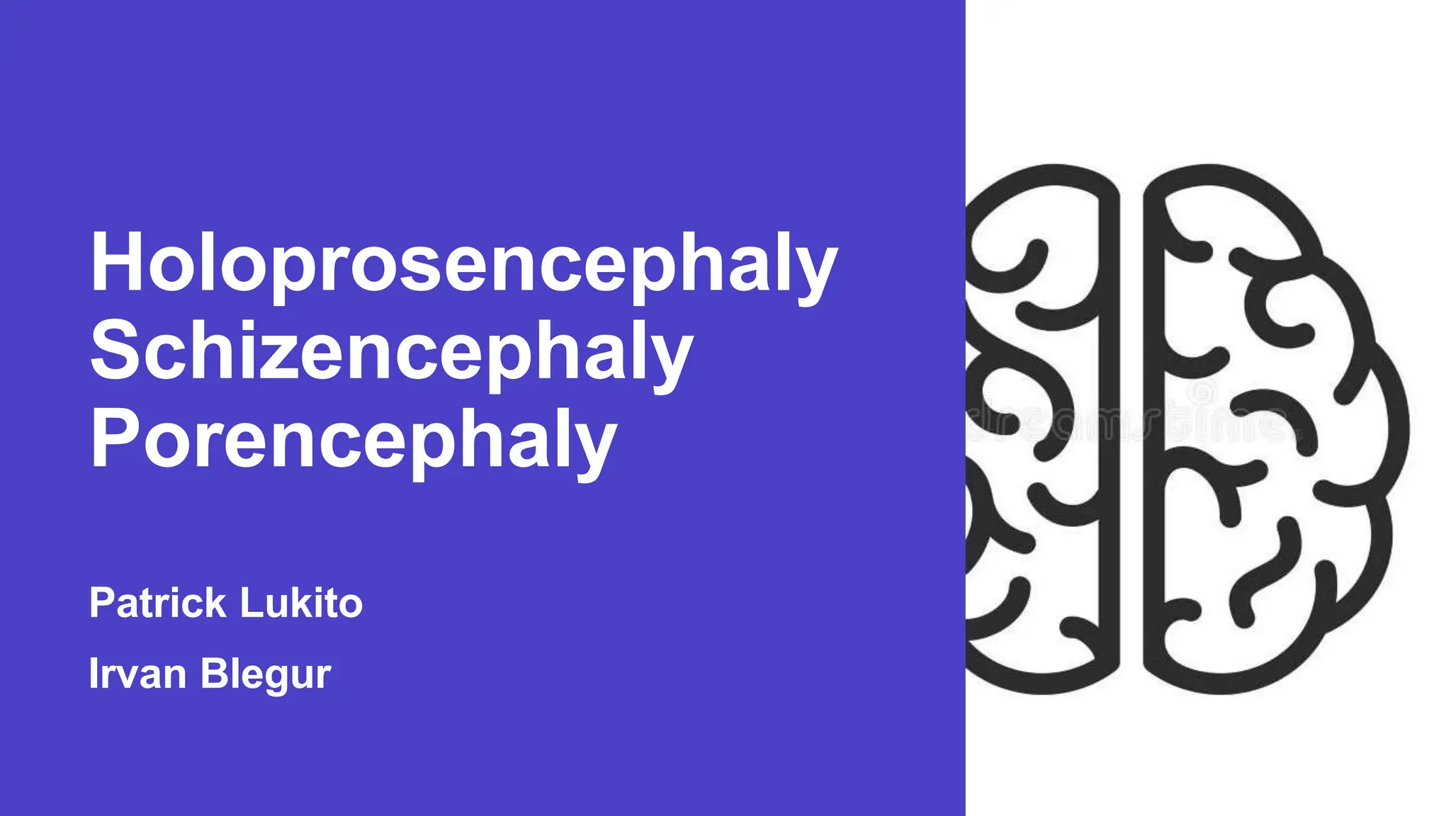 holoprosencephaly definition classification.pptx
