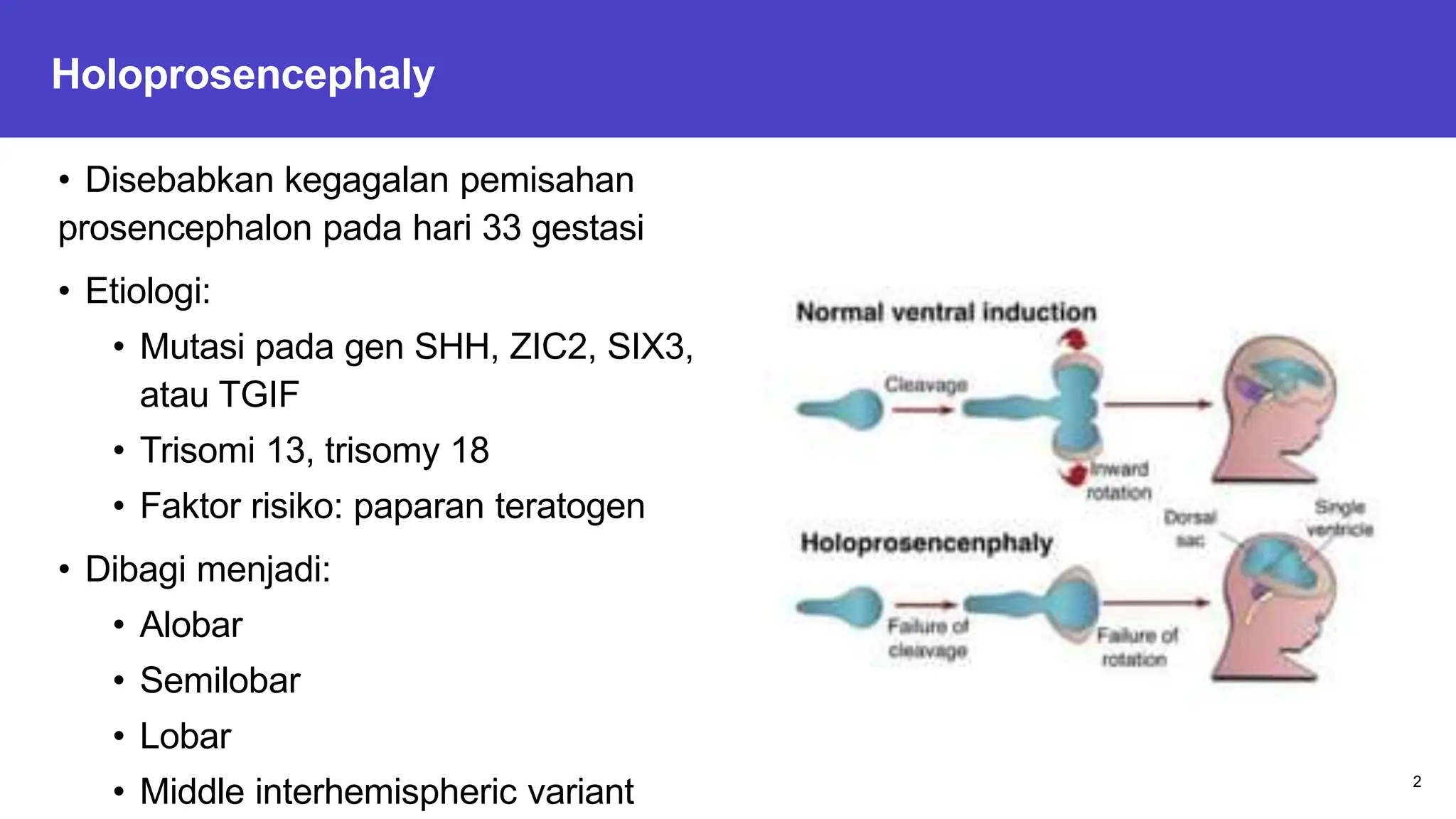 holoprosencephaly definition classification.pptx