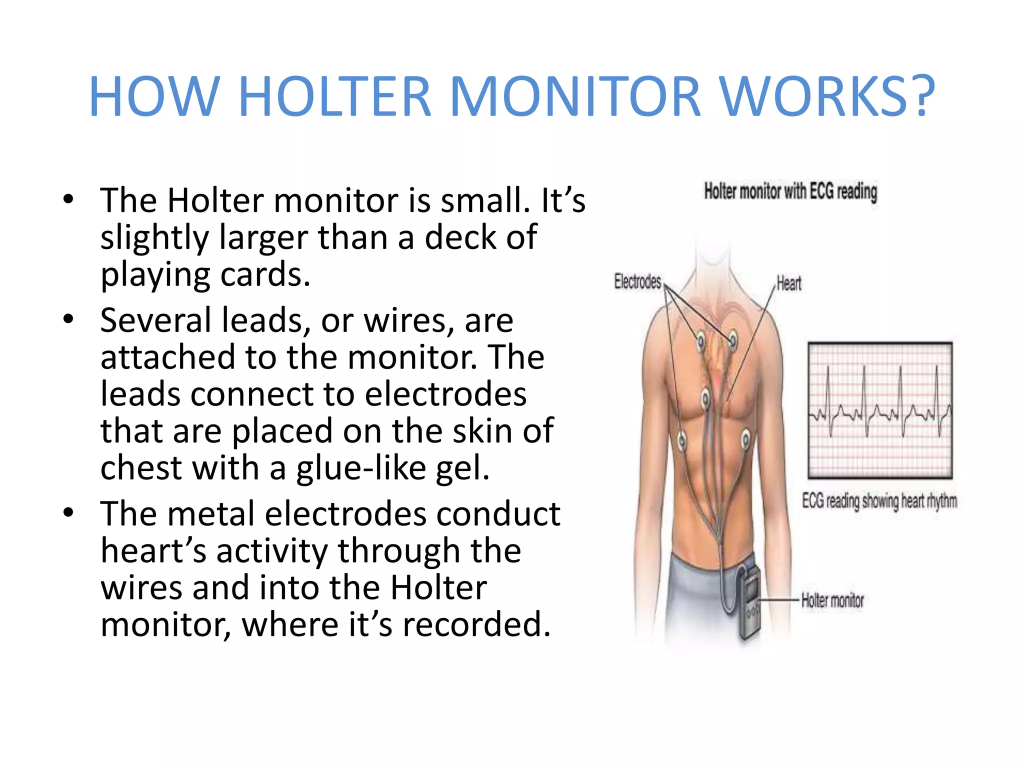 Holter | PPTX