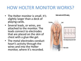 Holter | PPTX