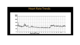 Approach to holter monitoring and it's indication | PPTX
