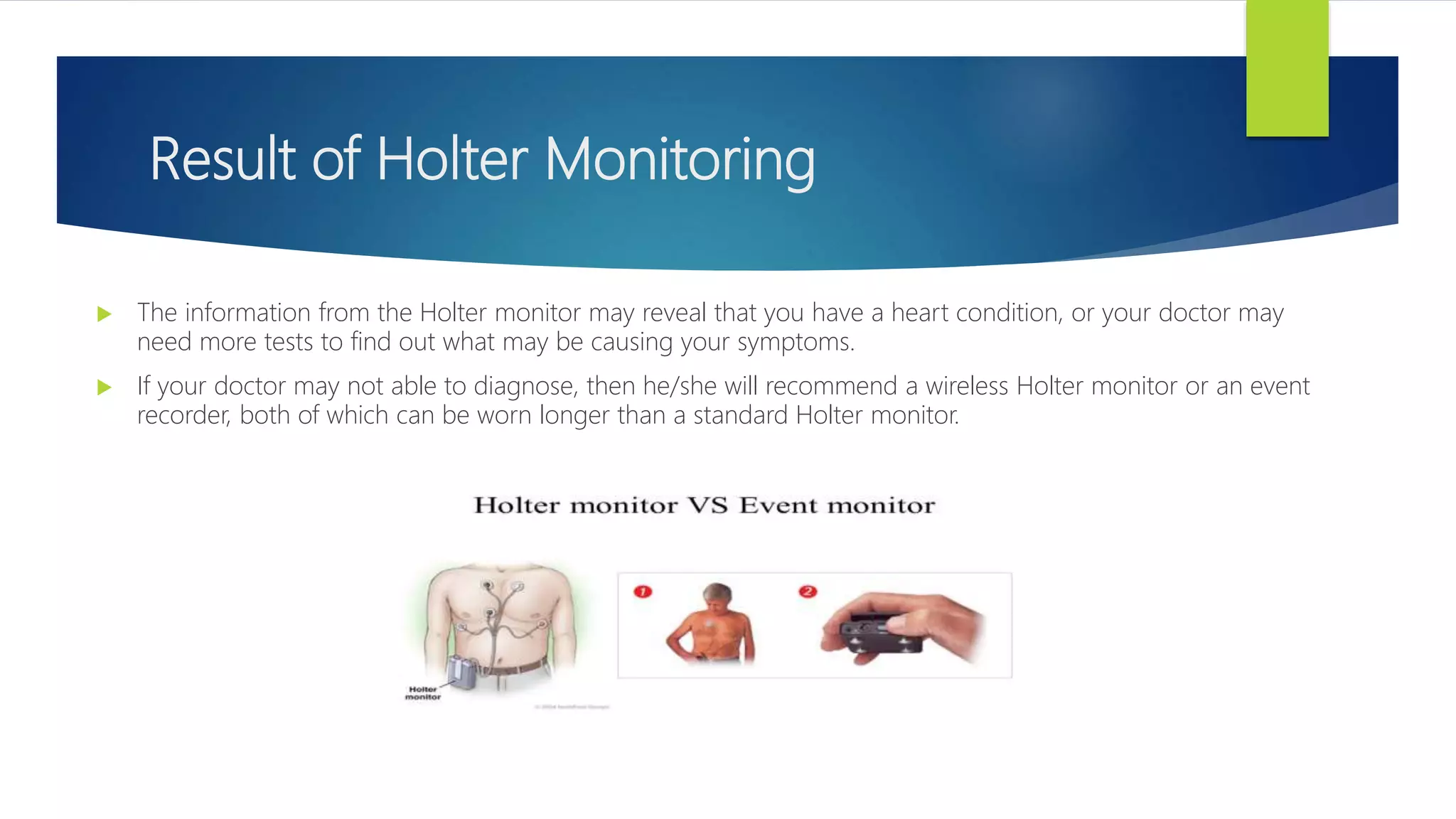 Holter monitoring | PPTX