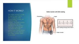 Holter monitoring | PPTX