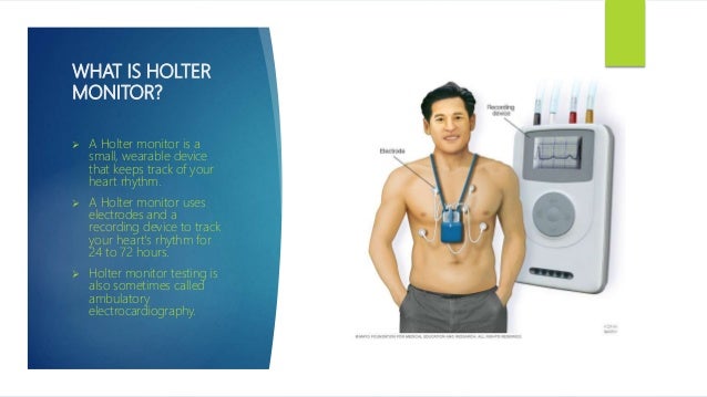 Holter monitoring