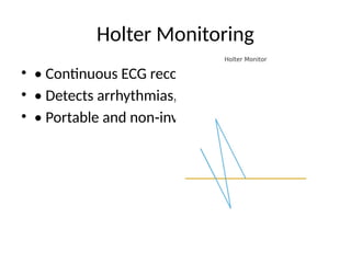 holter_monitoring_and_its _types_s.m.pptx