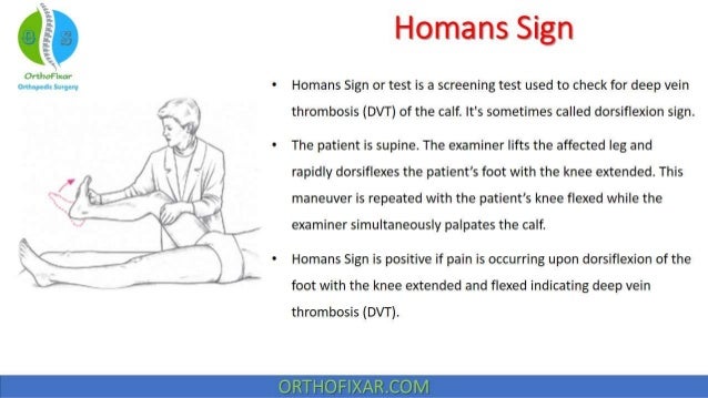 Homan’s Sign for DVT.pptx
