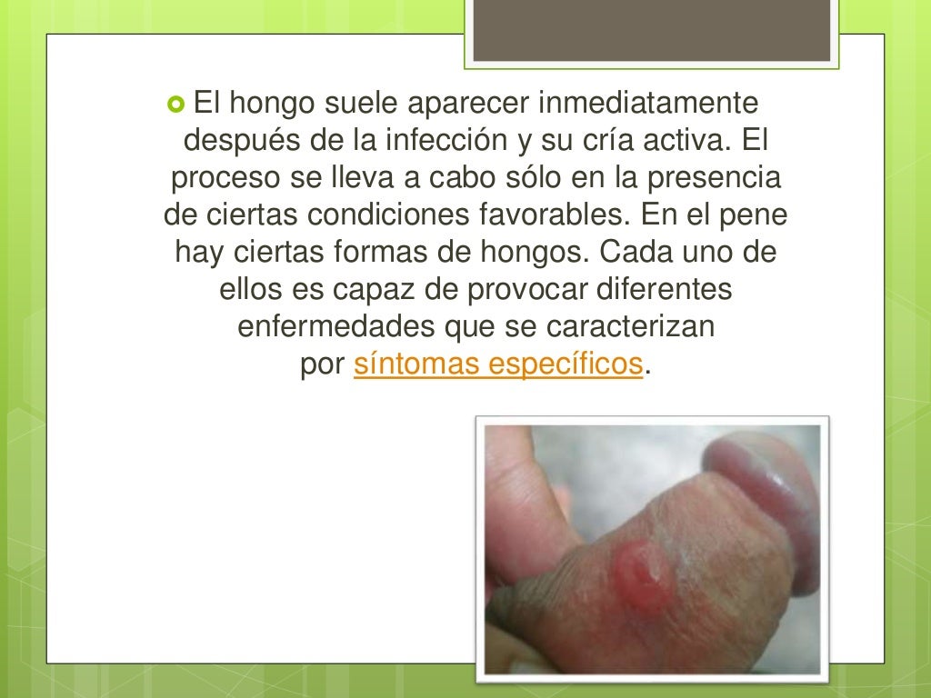 Hombres con infecciones hongos genitales o levaduras posible 3 remedi…
