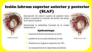 Patologias de hombro | PDF