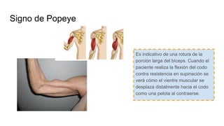 Hombro- pruebas especiales diagnostico especifico | PDF