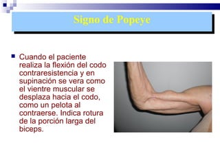 Hombro doloroso | PPT