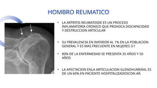 HOMBRO REUMATICO DR.ALEJANDRO MONROY CALDERON FELLOW | PPTX