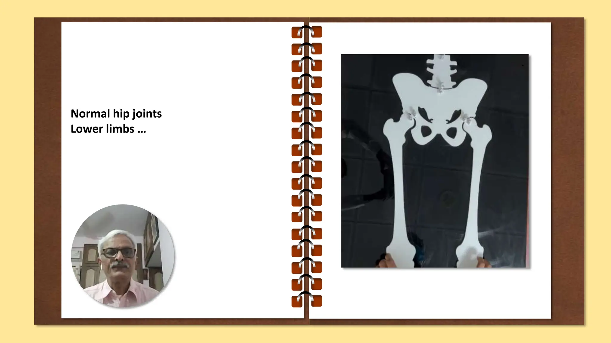 Squaring of the Pelvis in the examination of the Hip case ... HOME ...