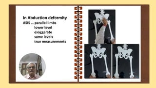 Squaring of the Pelvis in the examination of the Hip case ... HOME ...