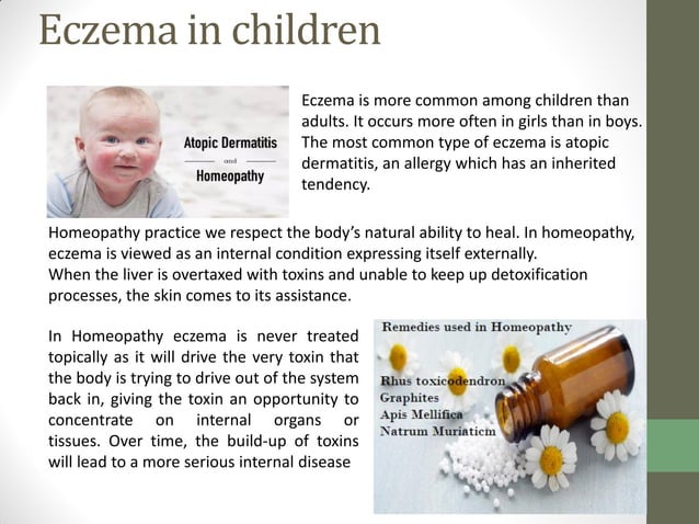 Homeopathy for Children | PDF | Skin and Dermatology | Diseases and ...
