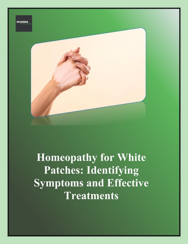 Homeopathy for White Patches_ Identifying Symptoms and Effective ...