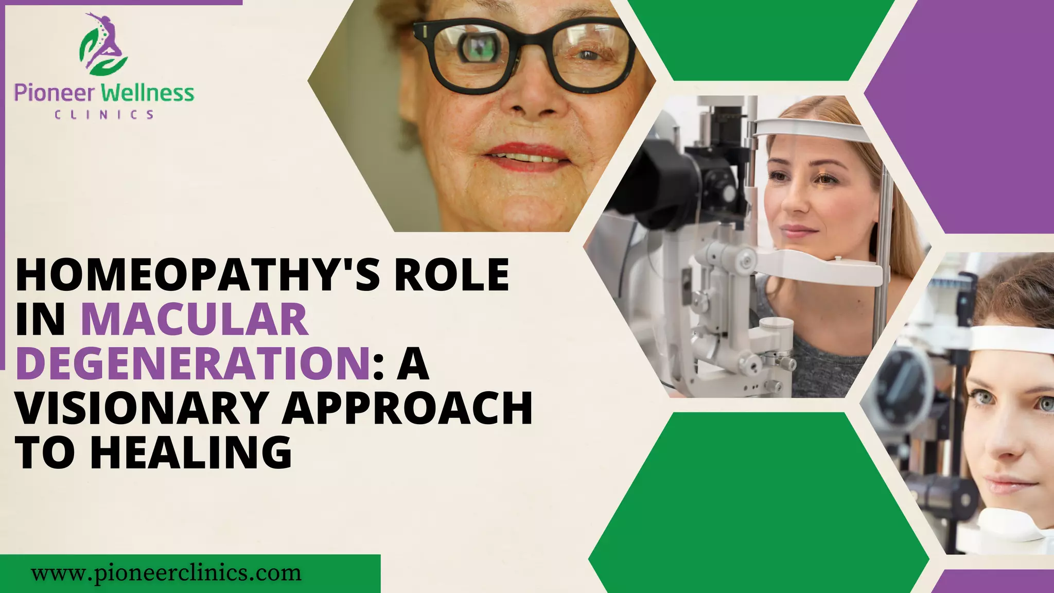 Homeopathy's Role in Macular Degeneration: A Visionary Approach to ...