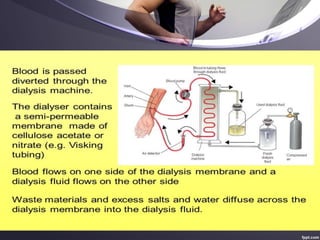 Edexcel IGCSE - Human Biology - Chapter 08 - Homeostasis and Excretion ...