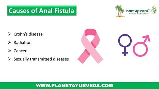 Treatment of Anal Fistula with Home Remedies - Without Surgery | PPTX