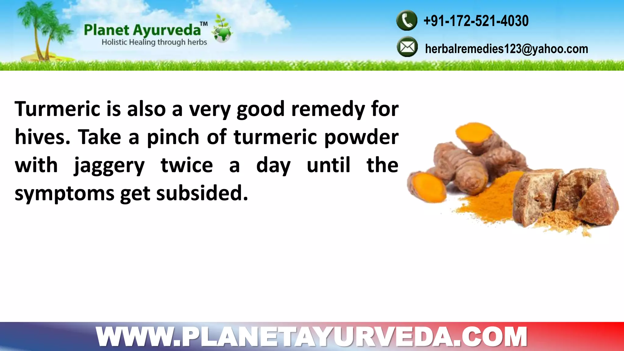 Home Remedies To Get Rid Of Hives or Urticaria | PPTX