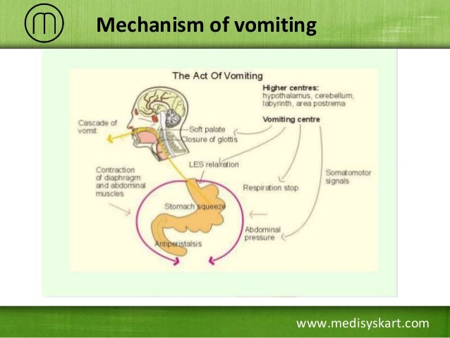 Home Remedies to Stop Vomiting
