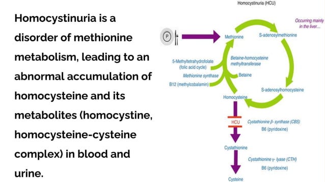 Homocystinuria | PPT