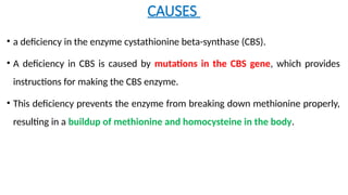homocystinuria in children/ Homocystinuria.pptx